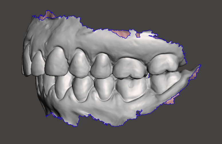 What are "In Occlusions" Scans?