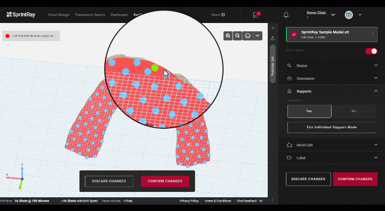 Modifying Model Angulation and Supports